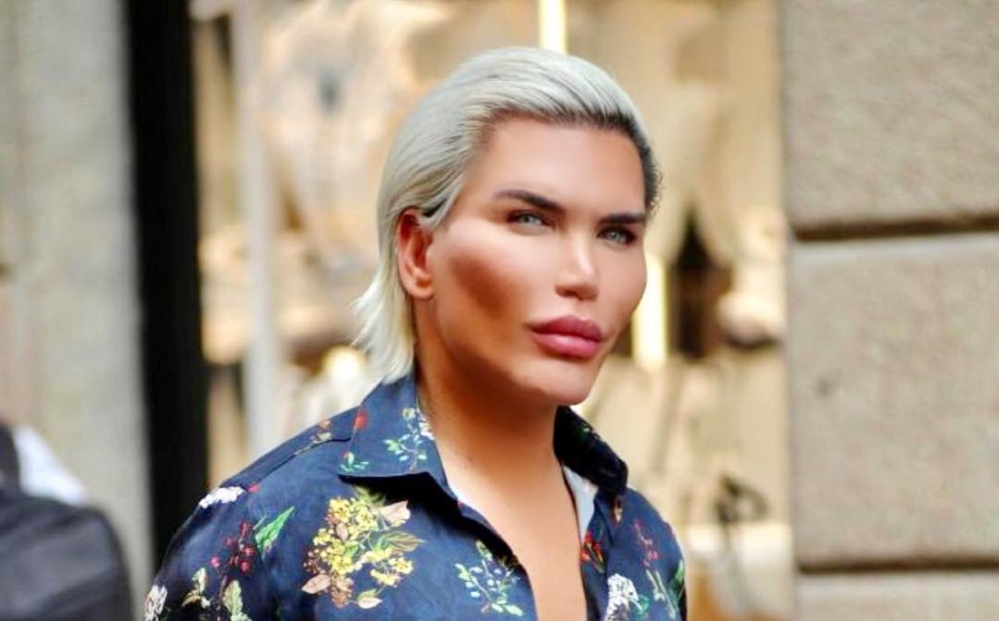 Ken Humano brasileiro, Rodrigo Alves, mostra foto de antes das ...